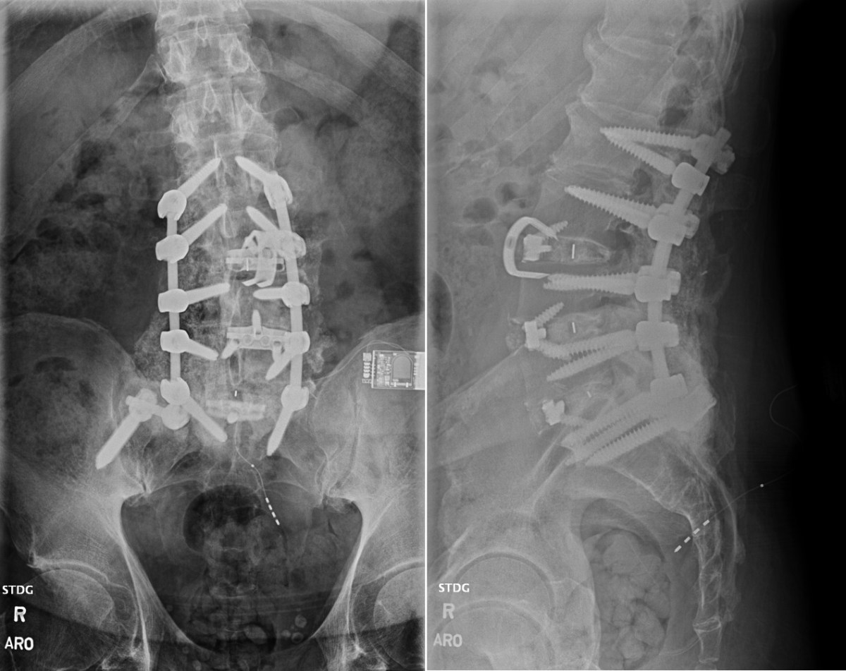 Dealing with Disappointment and Emotional Pain When Things (Seemingly ...