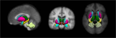 “Navigating the Complexity: Differentiating MSA from Similar ...